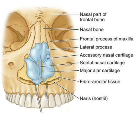 ABSCESS SUBPERIOSTEAL AS COMPLICATIONS SINUSITIS MAXILLARY DENTOGEN IN ...