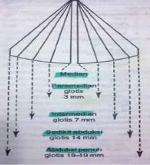 VOCAL FOLD PARALYSIS | ORLHNS