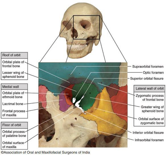 Orbital Floor Fractures | ORLHNS
